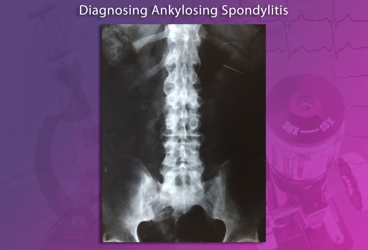 Back Pain: The Latest in Diagnosis and Management