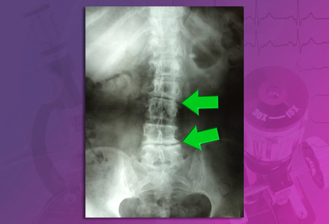 Back Pain: The Latest in Diagnosis and Management