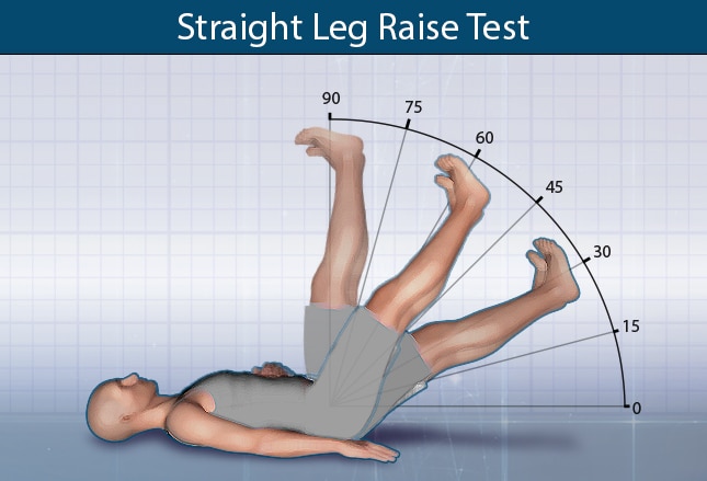 Back Pain: Find the Cause, Watch for the Comeback