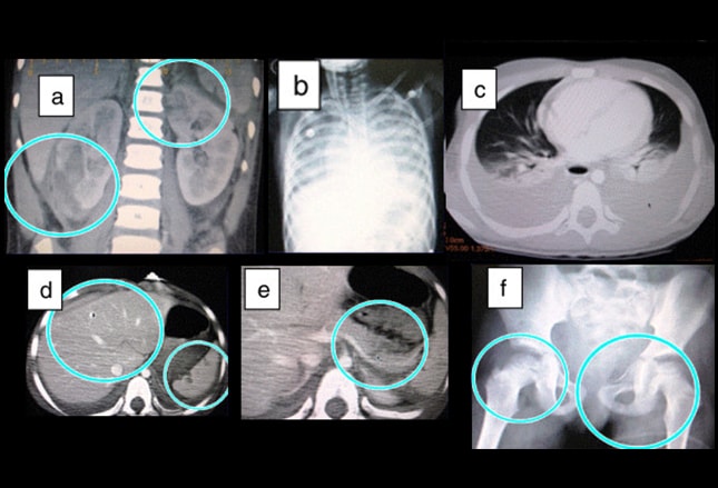 Hard Hits: Blunt Force Trauma