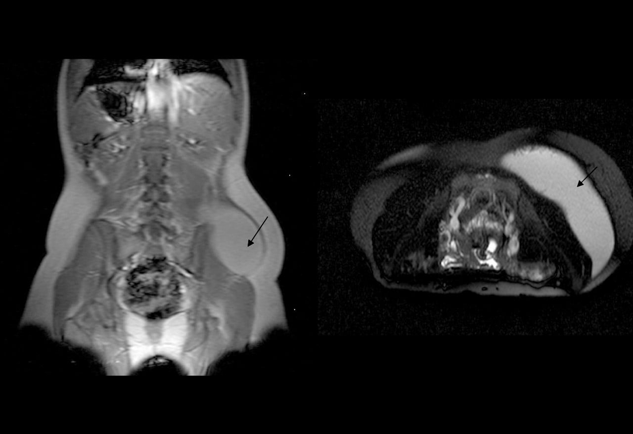 Hard Hits: Blunt Force Trauma