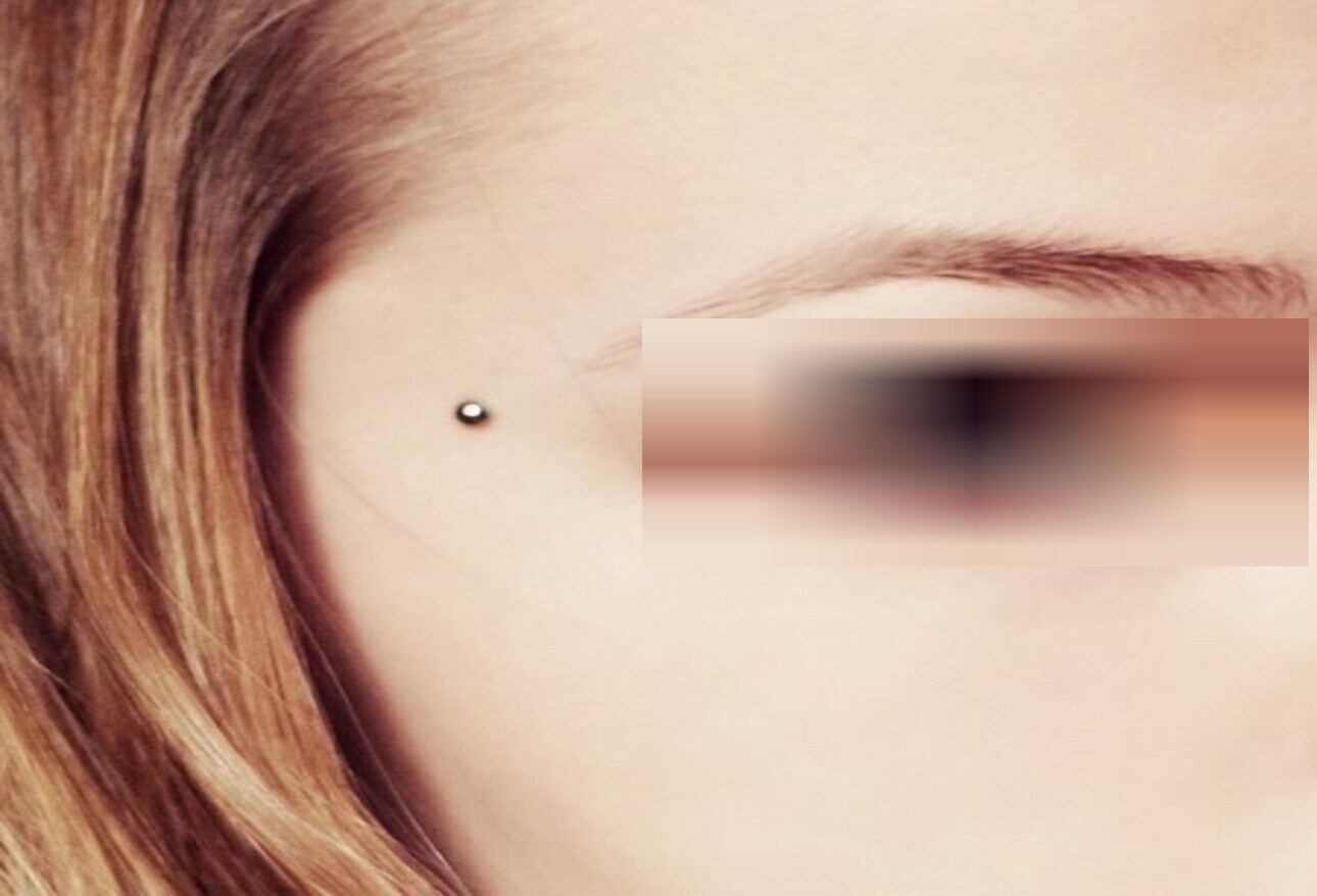 Body Modifications: Dermatologic Reactions and Risks