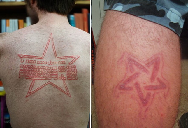 6 Body Modifications: Dermatologic Risks and Adverse Reactions