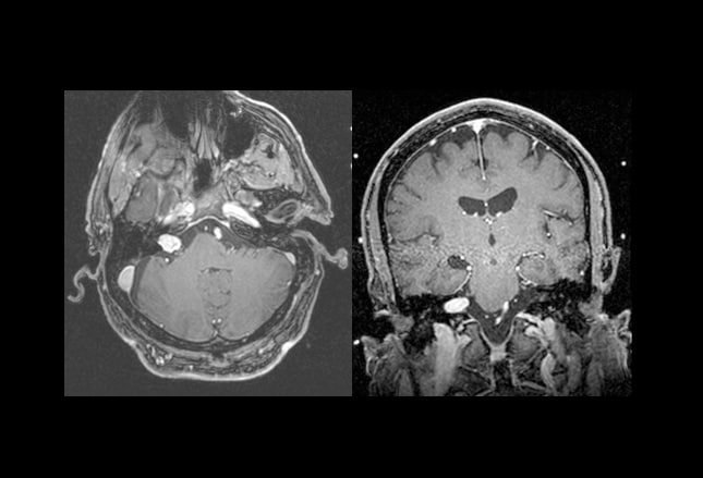 10 Brain Lesions to Recognize