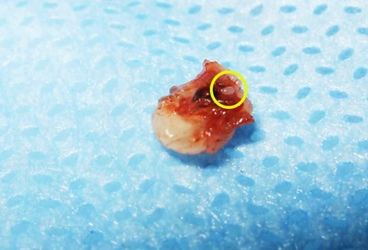 7 Bug Bites You Need to Know