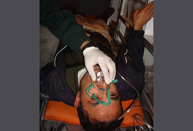 Burn Injuries: Complications and Care Options