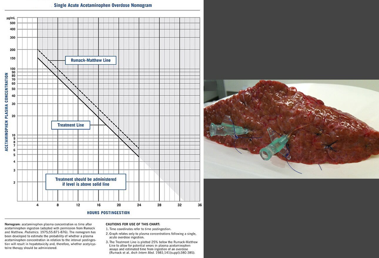 13 Common Pediatric Ingestions to Know