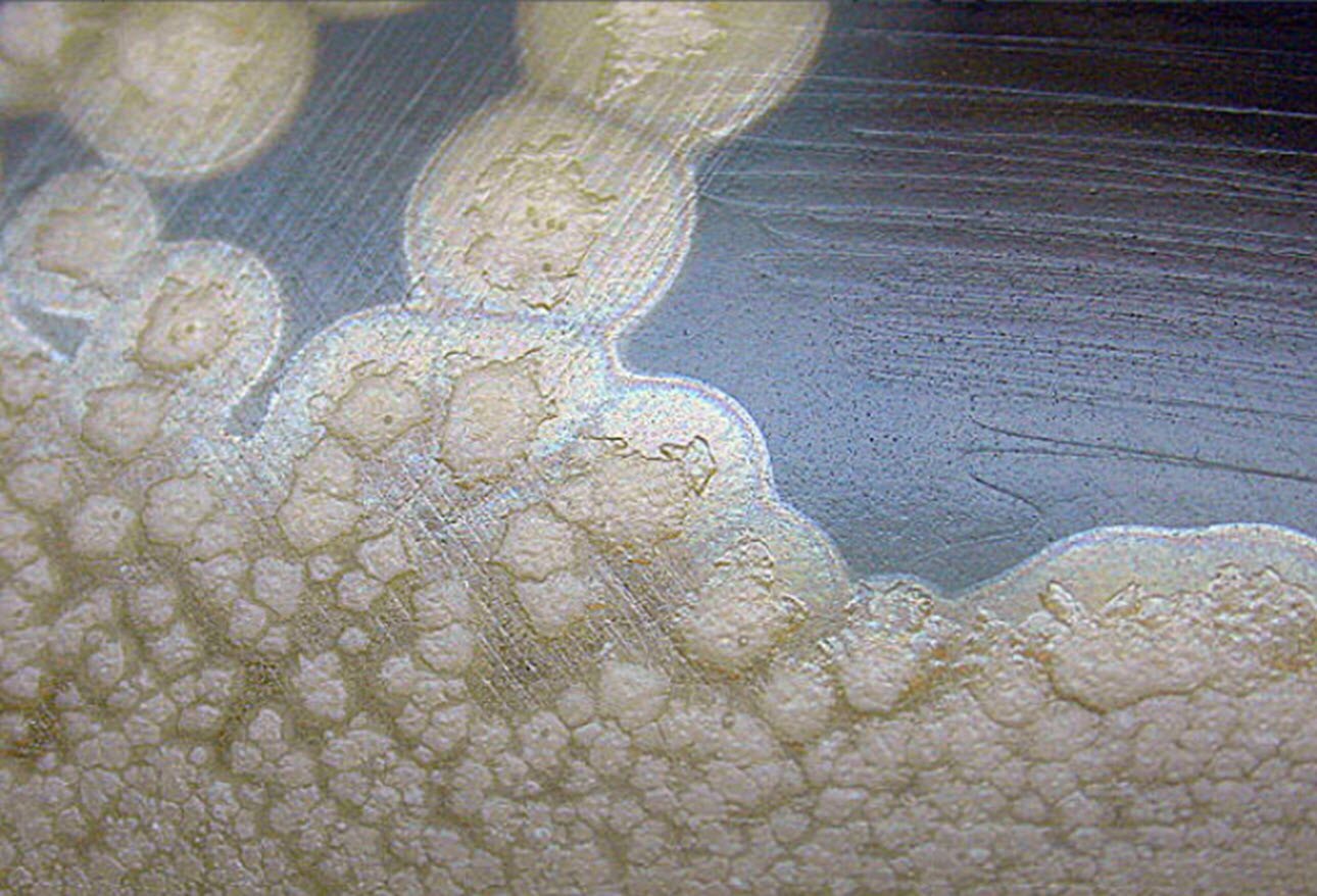 11 Community-Acquired Infections