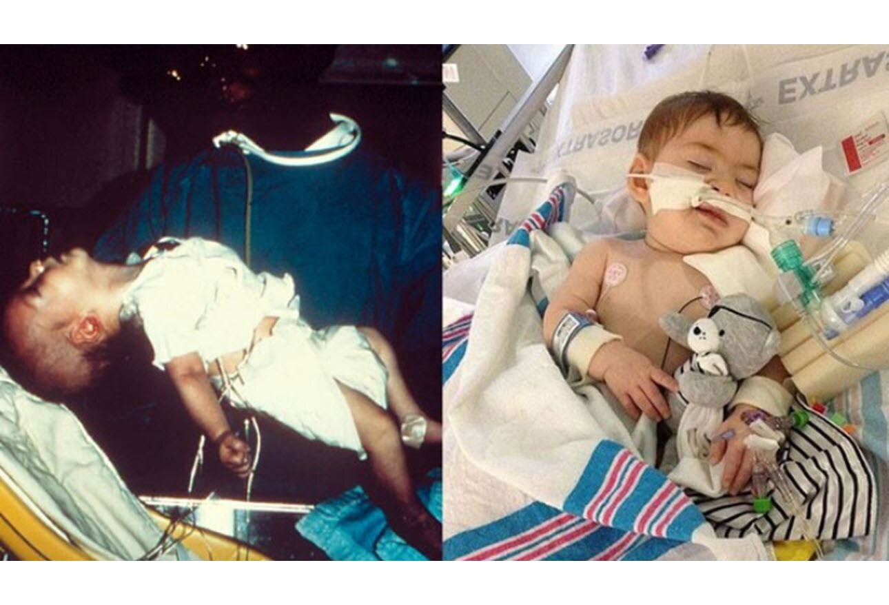 11 Community-Acquired Infections