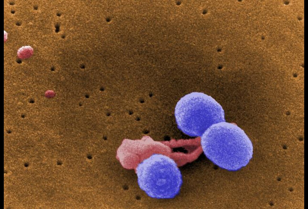 11 Community-Acquired Infections