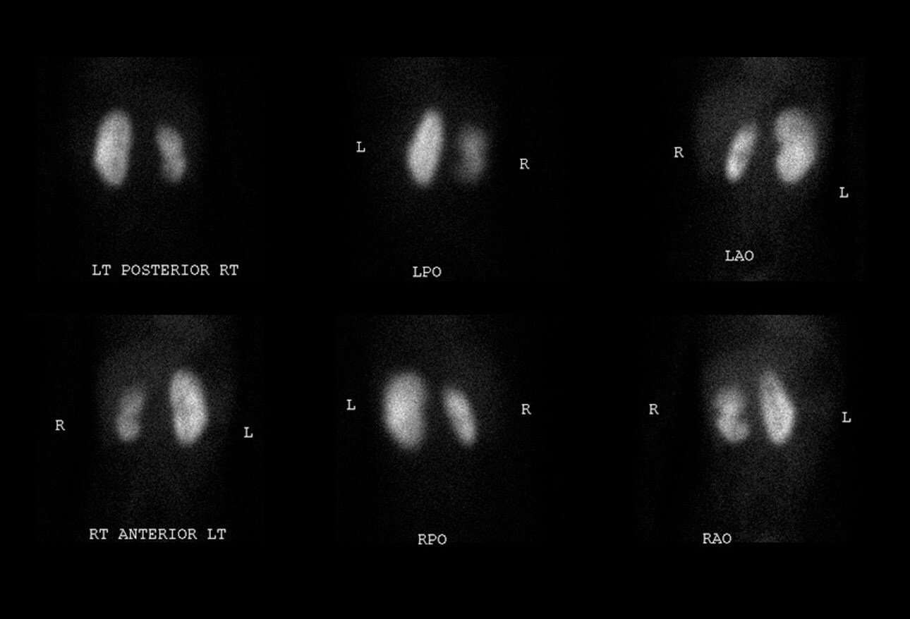 Congenital Anomalies of the Genitourinary System