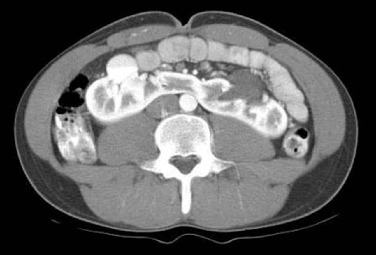 Congenital Anomalies of the Genitourinary System
