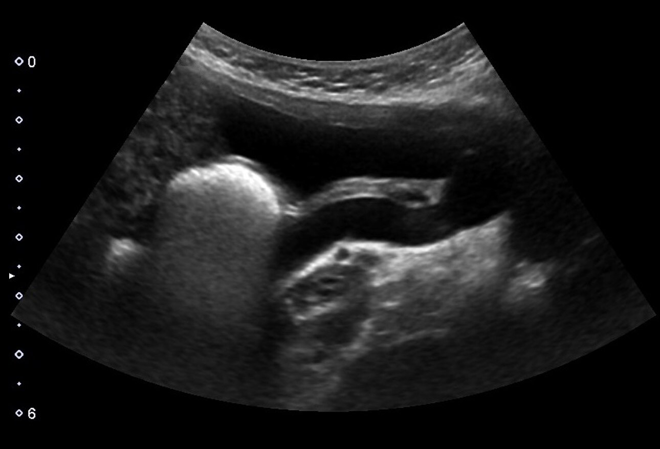 Congenital Anomalies of the Genitourinary System