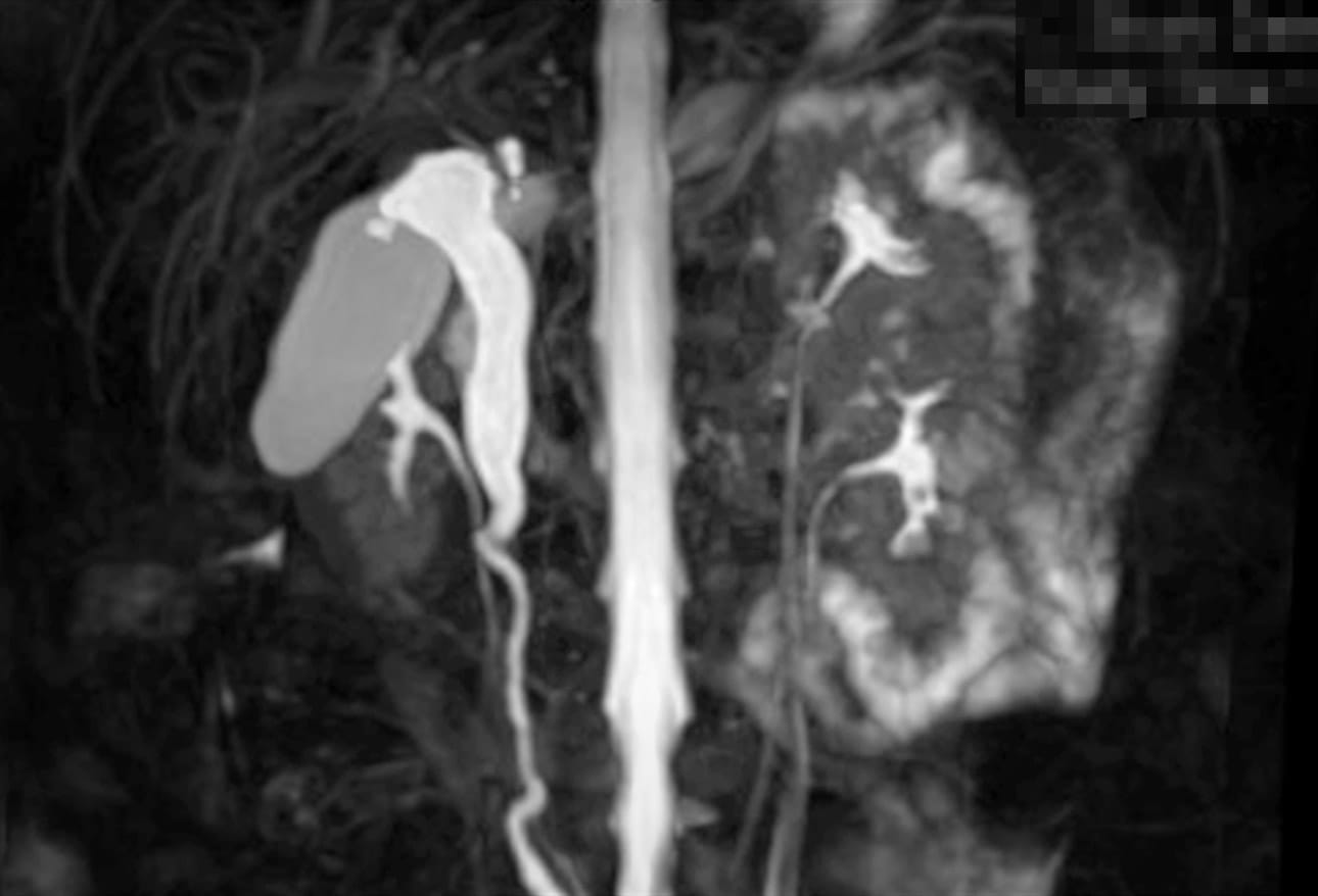 Congenital Anomalies of the Genitourinary System