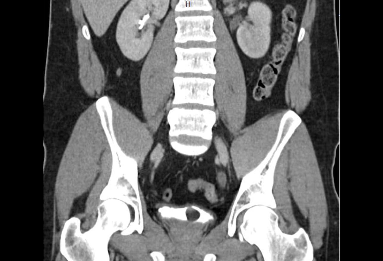 Congenital Anomalies of the Genitourinary System
