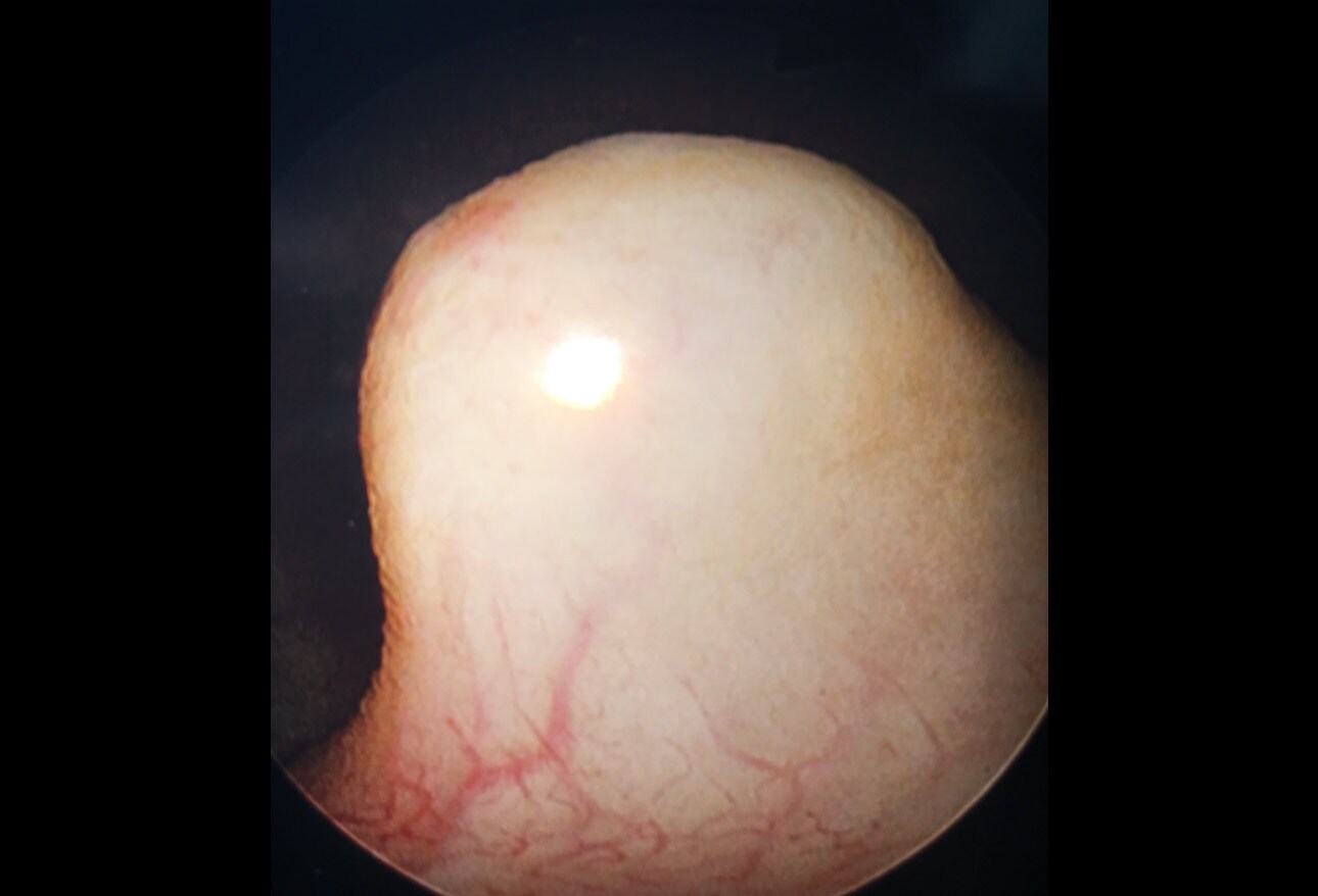Congenital Anomalies of the Genitourinary System