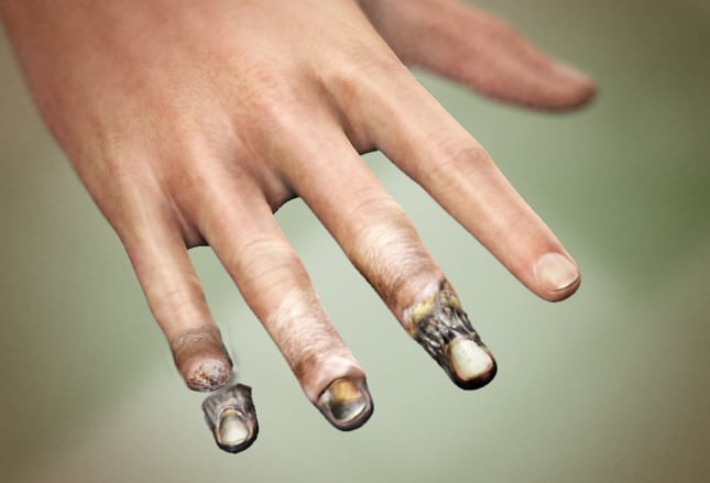 Physical Manifestations of 9 Drugs of Abuse