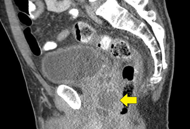 Dysuria: When It Hurts to Go With the Flow