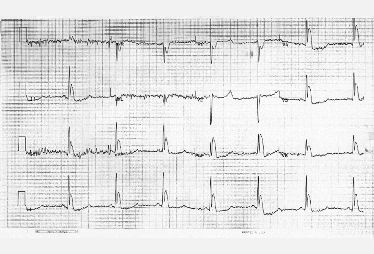 On Strike or Working Overtime: 12 Endocrine Emergencies