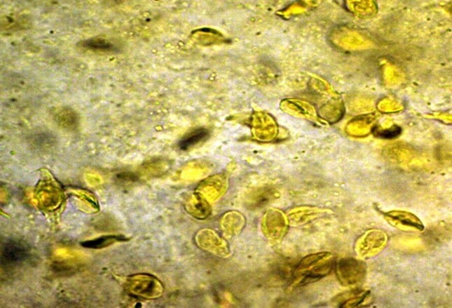 10 Cases of Food Poisoning: Find the Pathogen Responsible