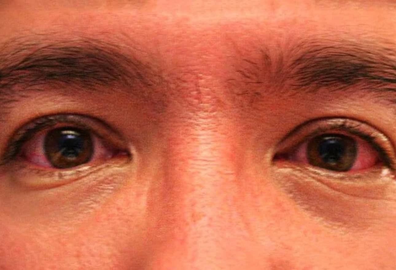 8 Cases of Food Poisoning: Find the Pathogen Responsible