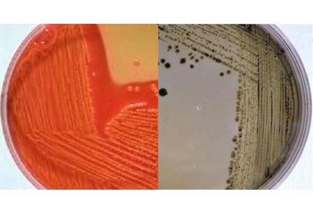 8 Cases of Food Poisoning: Find the Pathogen Responsible