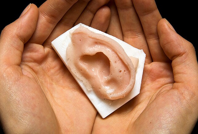 3D Printing 10 Examples Of How It Has Changed Medicine