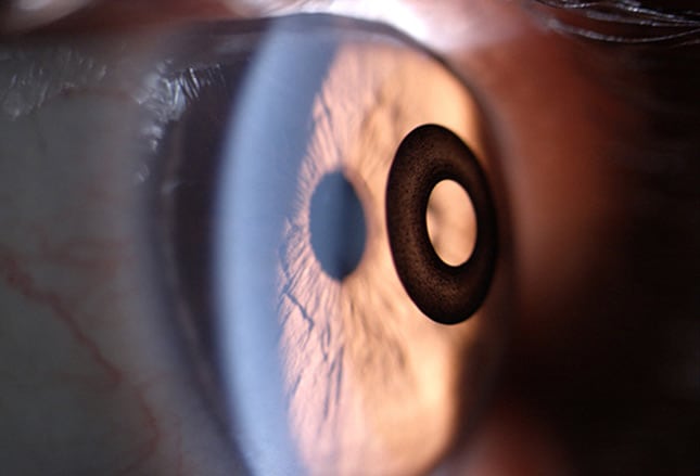 10 Vision-Saving Advances in Medicine