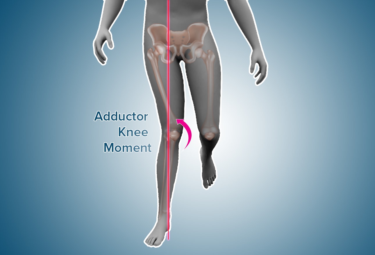 Gait Disorders: When the Patient Can't Walk the Walk
