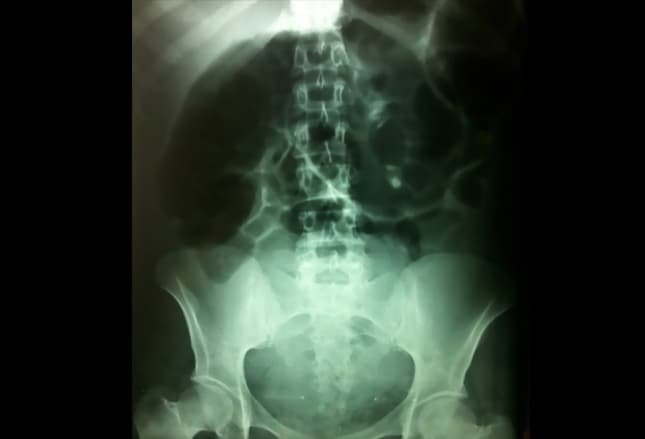 Can't-Miss Gastrointestinal Diagnoses