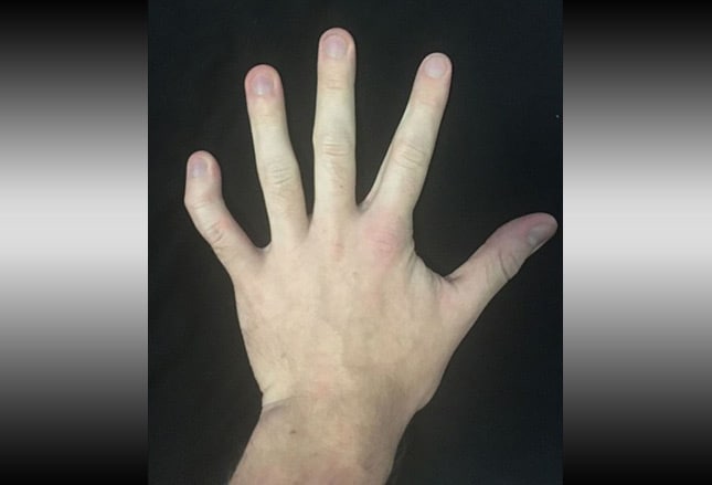 Understanding Growth Disorders: 7 Cases