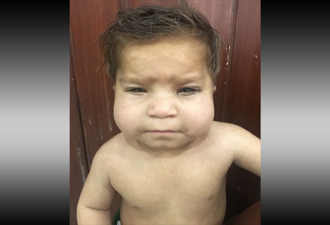 Understanding Growth Disorders: 7 Cases