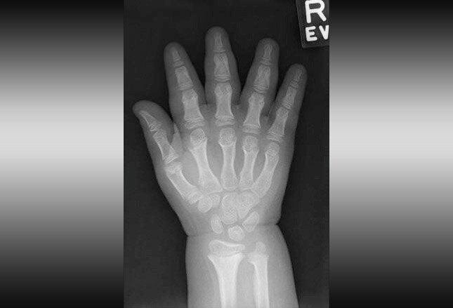 Growth Disorders: 10 Cases of a Developing Problem