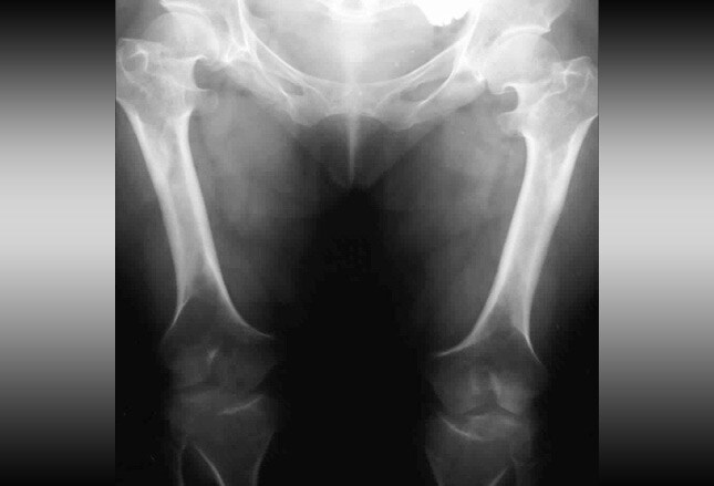 Growth Disorders: 10 Cases of a Developing Problem