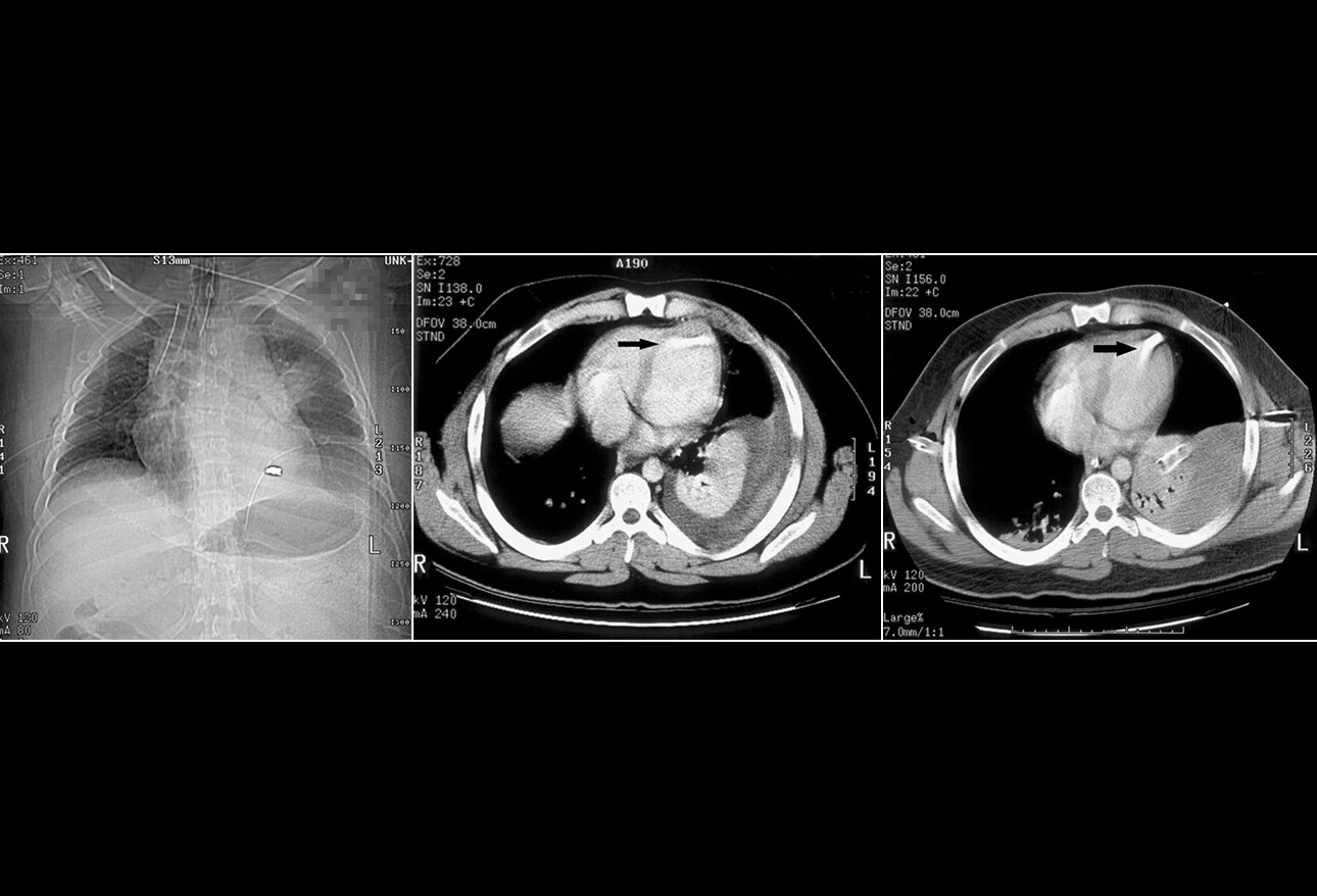 Gunshot Wounds: A Targeted Approach