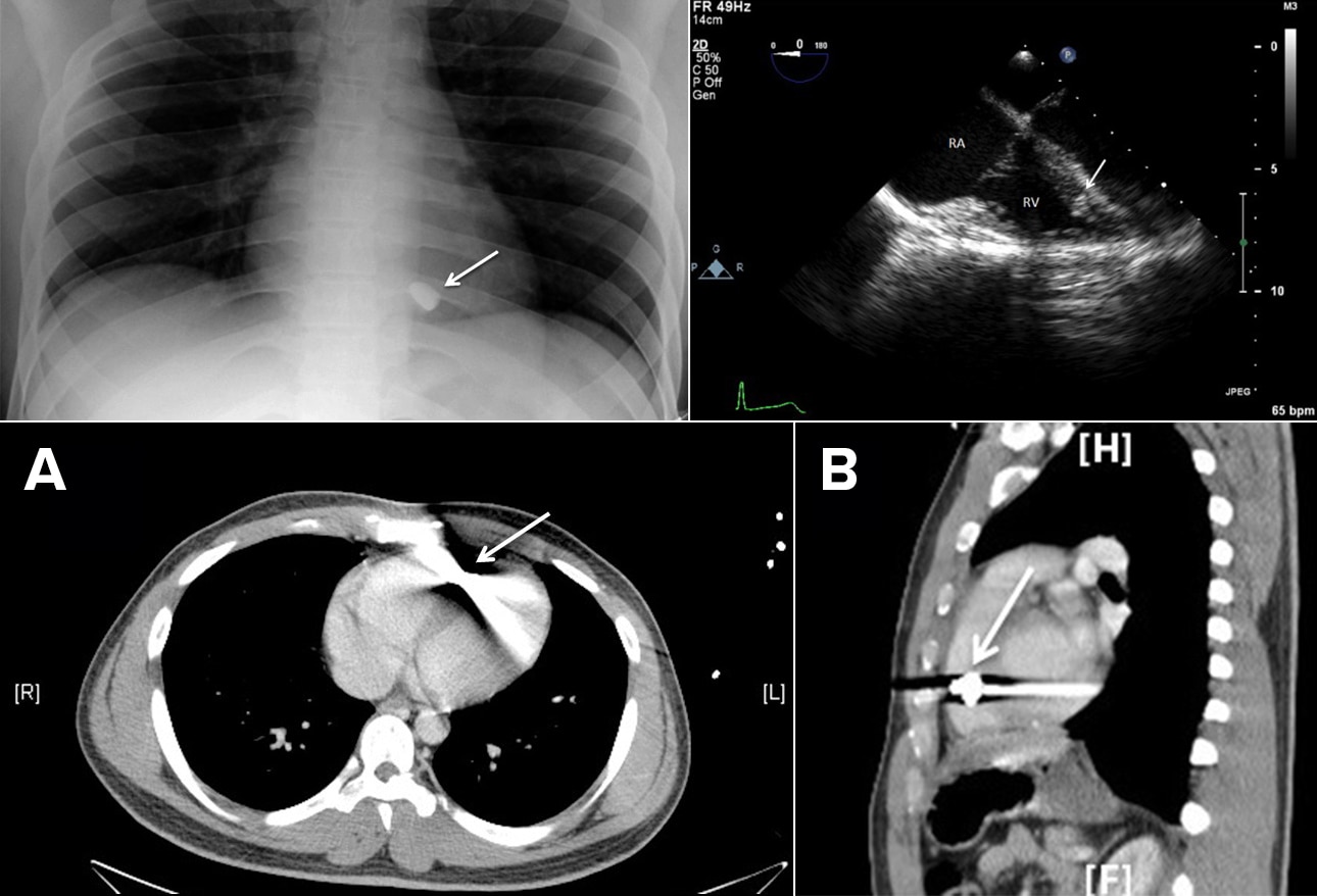 Gunshot Wounds: A Targeted Approach
