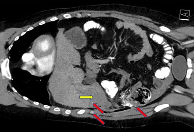 Gunshot Wounds: Damage and Death