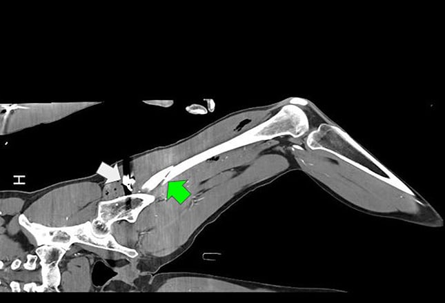 Gunshot Wounds: Damage and Death