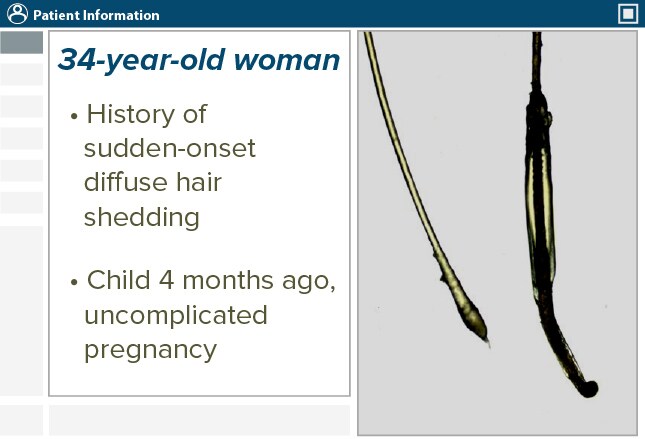 Hair Disorders: Finding the Root of the Problem