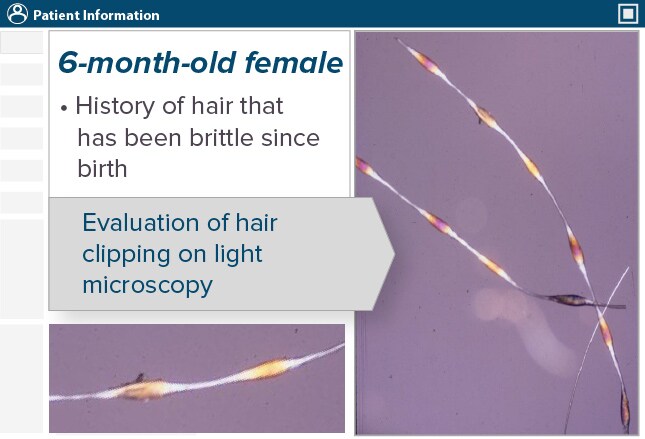 Hair Disorders: Finding the Root of the Problem