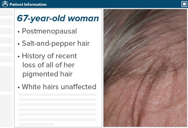 Hair Disorders: Finding the Root of the Problem