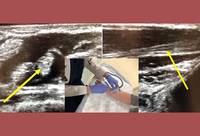 14 Can't-Miss Hand Emergencies