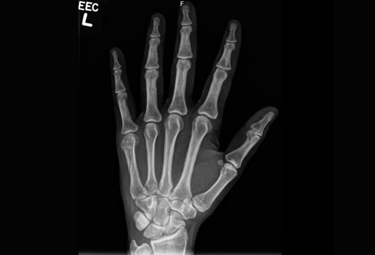 14 Can't-Miss Hand Emergencies