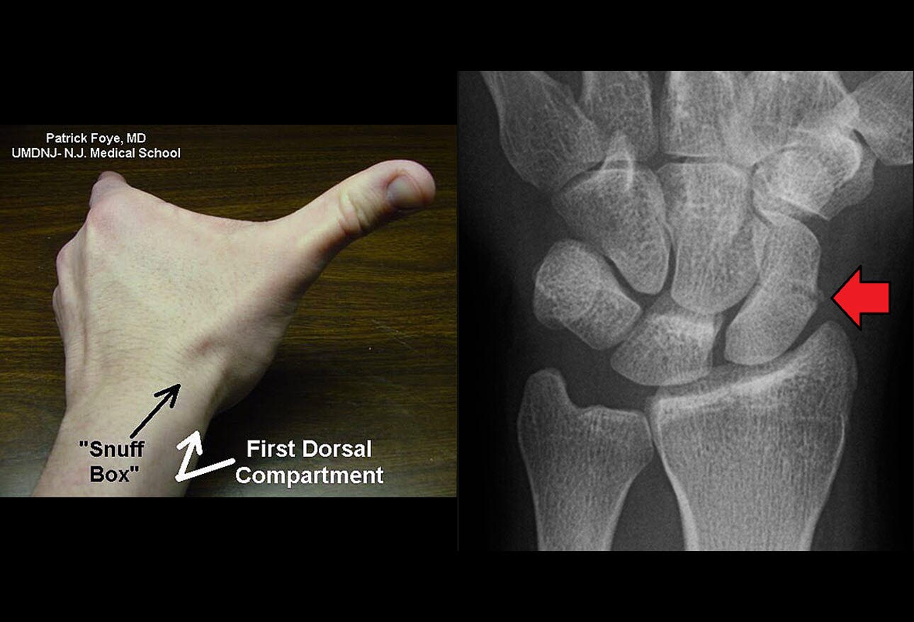 14 Can't-Miss Hand Emergencies