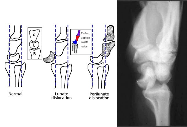 14 Can't-Miss Hand Emergencies