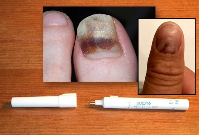 14 Can't-Miss Hand Emergencies