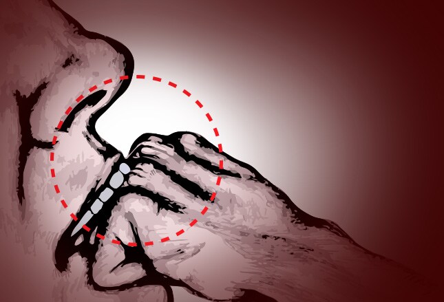 14 Can't-Miss Hand Emergencies