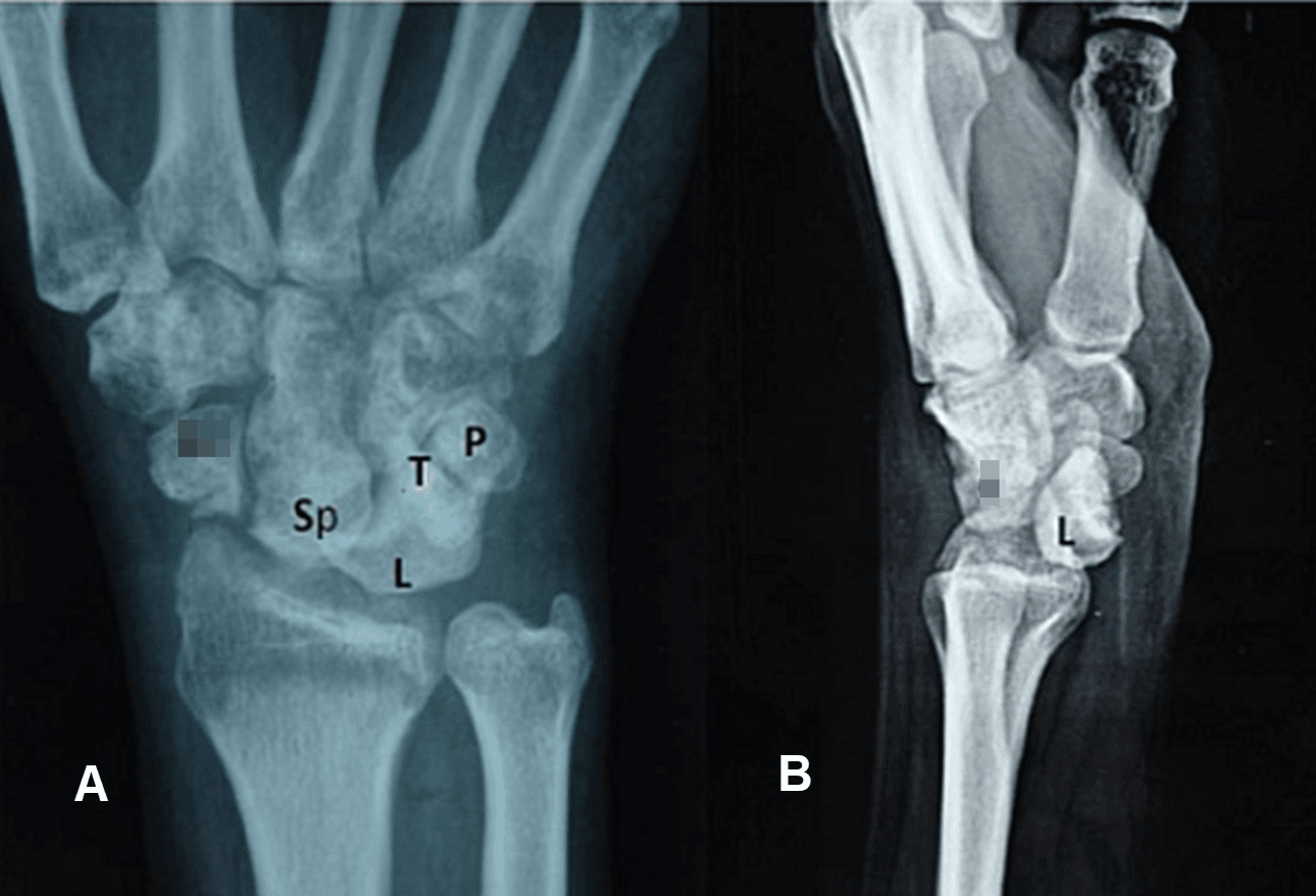 14 Can't-Miss Hand Emergencies