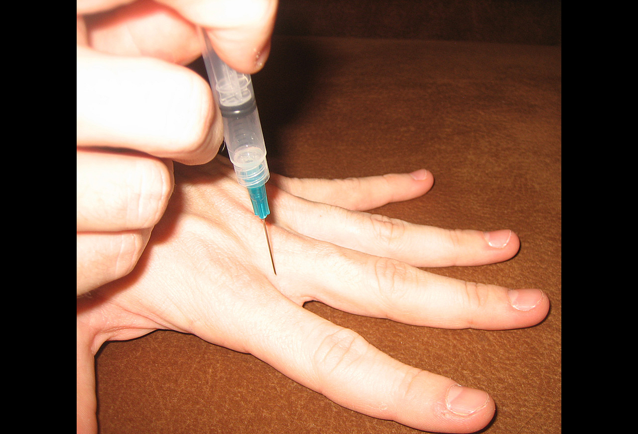 14 Can't-Miss Hand Emergencies