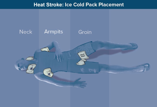 Burning Up? A Guide To Recognizing And Managing Heat Illness